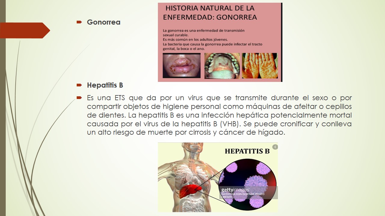 TOMi.digital - Infecciones de transmisión sexual