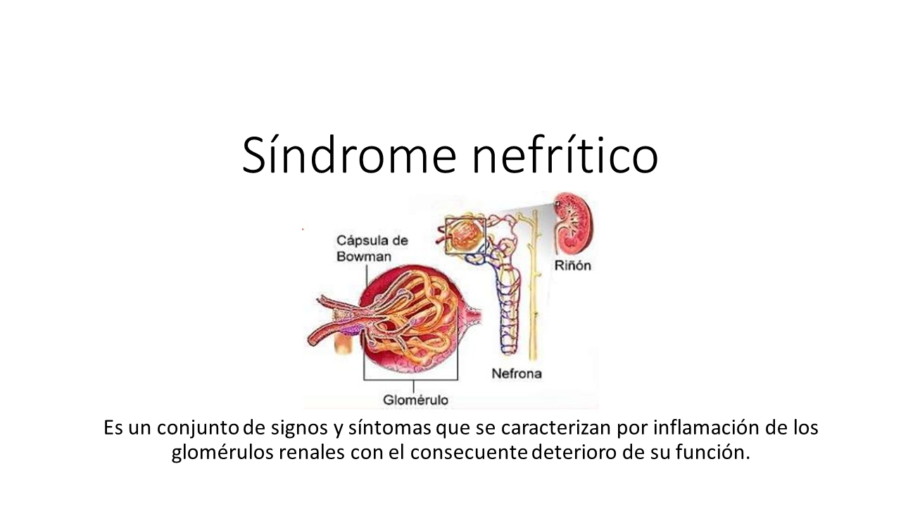 TOMi.digital - SÍNDROME NEFRÍTICO